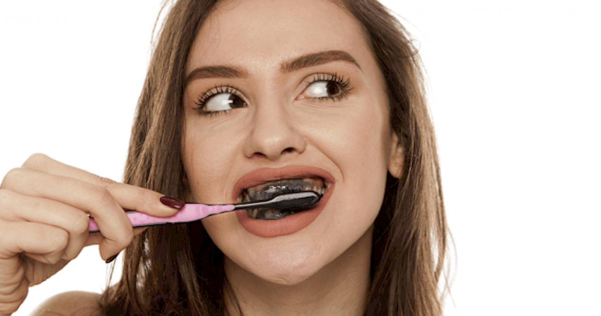 Ask The Dentist: Does Charcoal Whitening Work? | Recent News ... Ask The Dentist: Does Charcoal Whitening Work? | Recent News ...